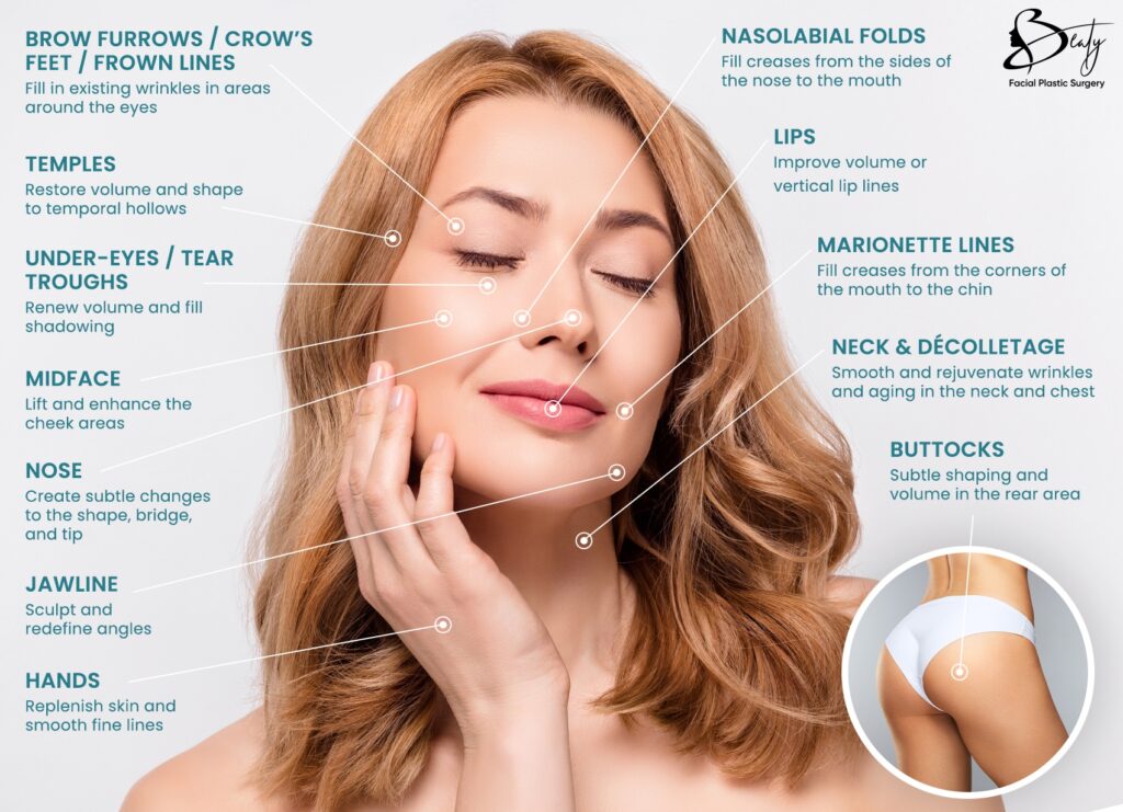 Injectable Filler By Area Atlanta Alpharetta GA