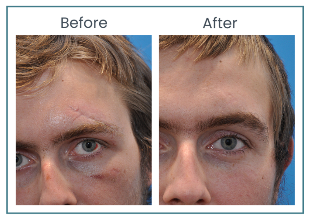 Facial Plastic Surgery Procedures Atlanta Alpharetta GA